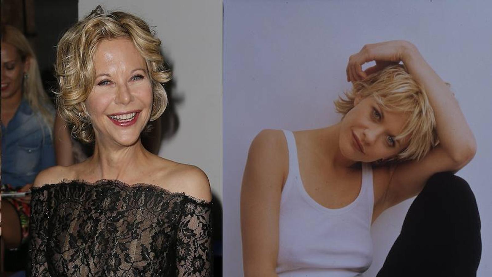 Celebrities transformados por el botox